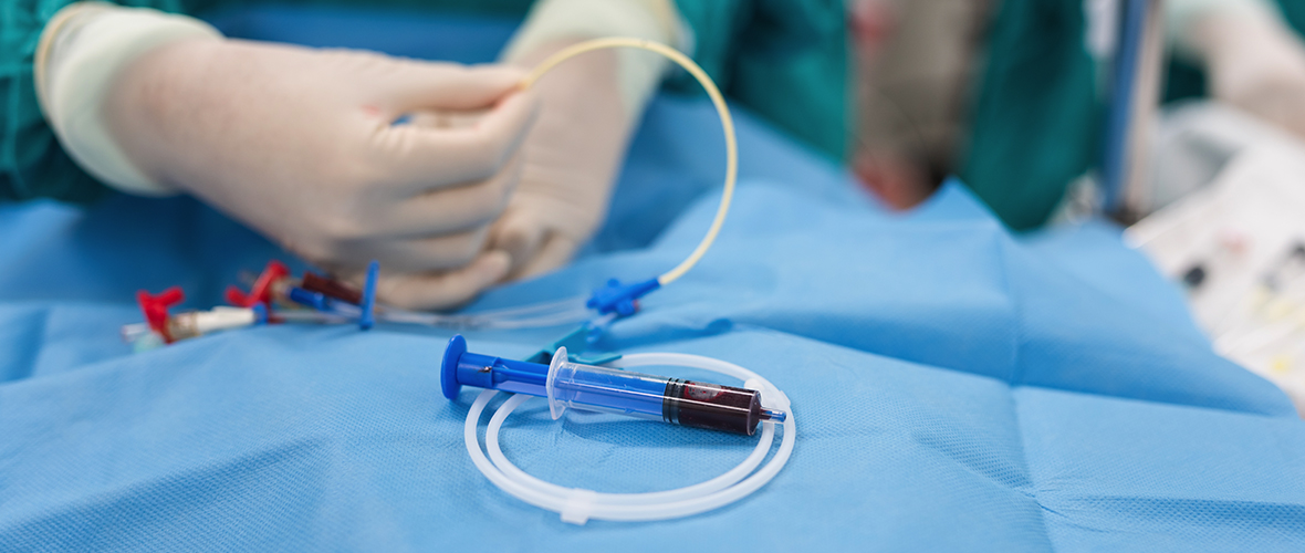 Custom Catheter Manufacturing - Medical Extrusion Technologies Inc.